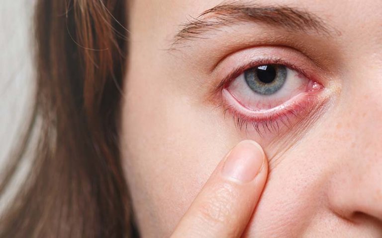 5 Common Eye Diseases In Adults - NaturalHealth - Healthy, Beauty ...